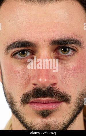Male itching, allergic reaction. Sensitive Skin, Food Allergy symptoms ...