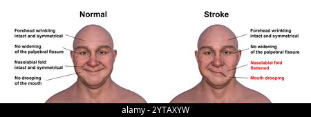 Facial muscles of the human face (with labels Stock Photo - Alamy
