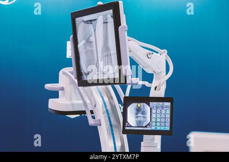 X-ray equipment C-arm with flat panel detector and monitor Stock Photo ...