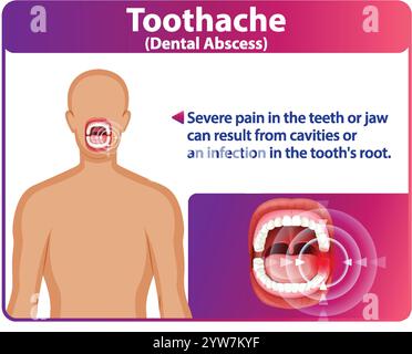 Illustration of toothache causes and symptoms Stock Vector Image & Art ...