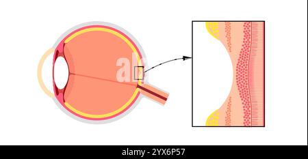 Macula fovea and foveola, illustration Stock Photo - Alamy