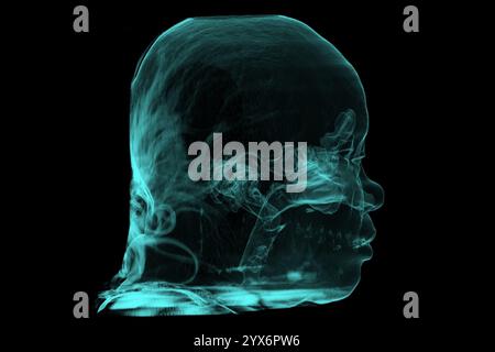 Paranasal sinus anatomy, CT scan Stock Photo - Alamy