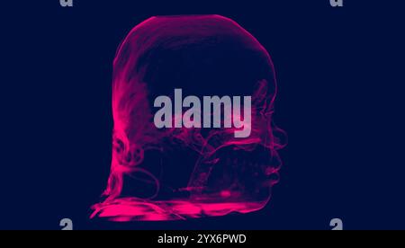Normal sinuses. Coloured computed tomography (CT) scan of a section ...