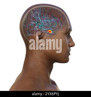 Human brain with the amygdala highlighted, computer illustration Stock ...