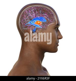 Computer illustration showing the third brain ventricle, a vital ...