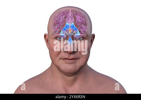 Computer illustration showing the third brain ventricle, a vital ...