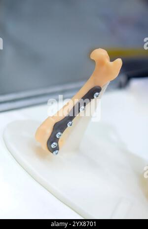 Implants and prostheses printed on 3D printer from biocompatible ...