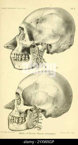 Skull of a Homo sapiens, anatomical illustration Stock Photo - Alamy
