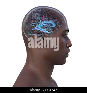 Illustration showing a normal lateral view of a maxilla (upper jaw) and ...