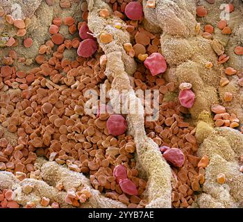 Uterus lining. Coloured scanning electron micrograph (SEM) of the ...