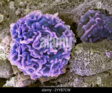Macrophage. Coloured scanning electron micrograph (SEM) of a macrophage white blood cell ...