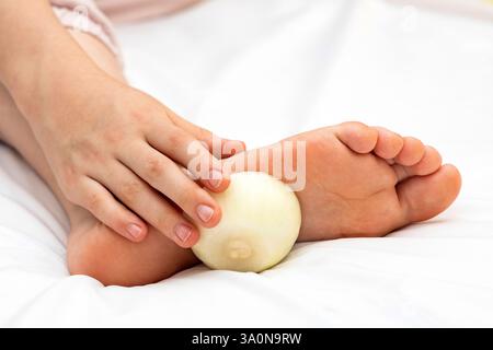 Onion cuts on the foot as a medical treatment Stock Photo - Alamy