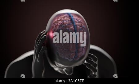 Conceptual illustration of pain symptoms originating from a brain ...