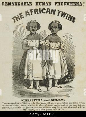 Millie and Christine McCoy were conjoined twins born in 1851, known for ...