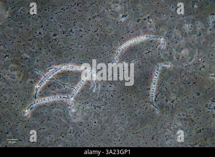 Macroconidia (microscopic asexual spores) produced by the fungus ...