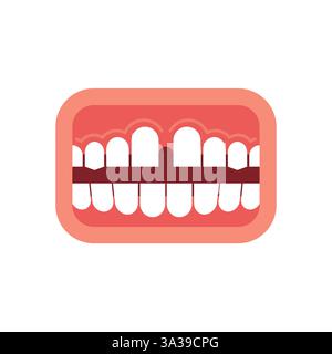 Gap mouth. Large space between teeth Stock Vector Image & Art - Alamy