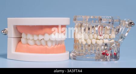 Dental models illustrating human tooth anatomy with external cavity and ...
