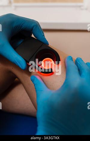 Vascular surgeon examines leg veins of woman using led venous scanner ...