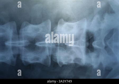X-ray image of spinal column as background, closeup Stock Photo - Alamy