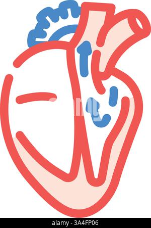 dilated cardiomyopathy cardiology disease color icon vector ...