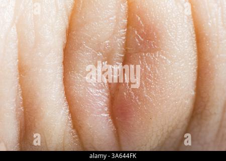 Schliess die menschliche Haut. Macro Epidermis Stock Photo - Alamy