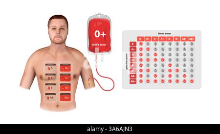 A medical illustration of an A Positive donor, showing transfusion ...