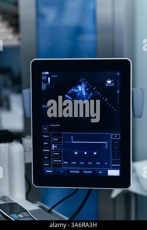 Close-up Ultrasound image on the monitor in the operating room during ...