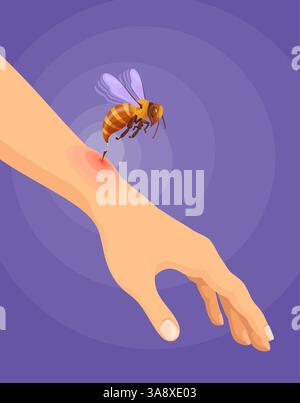 Bee bites sting on skin illustration Stock Vector Image & Art - Alamy