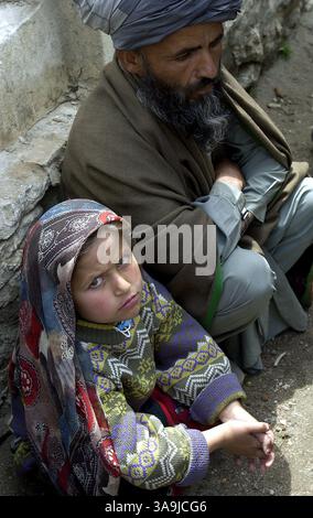 Apr 07, 2002; Kabul, Afghanistan; Afghan civilian bombing victim Amina ...