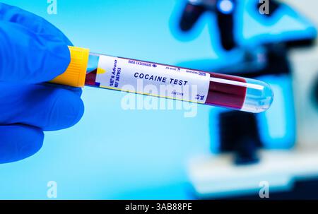 Cocaine blood test. Screens for cocaine and its metabolites, a powerful ...