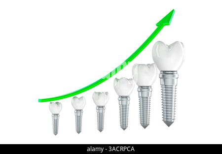 Dental Implant with growing chart. 3D rendering isolated on white ...