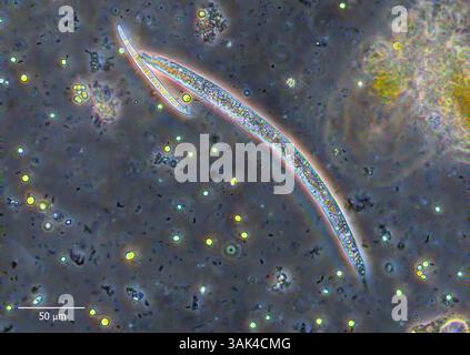 Macroconidia (microscopic asexual spores) produced by the fungus ...
