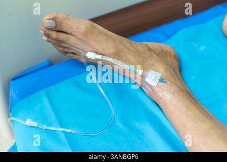 Patient asian elder man 80s with saline intravenous at C-line or A-line ...