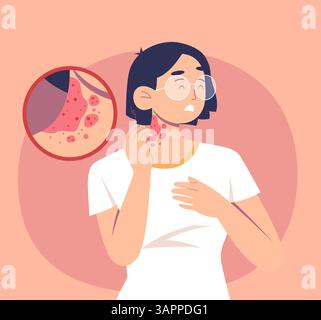Painful Skin Rashes and Spots on Neck - Stock Illustration as EPS 10 ...
