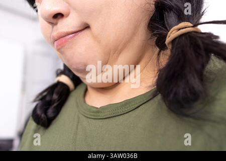 Double chin face mature woman 50 years old, human fat neck, side view ...