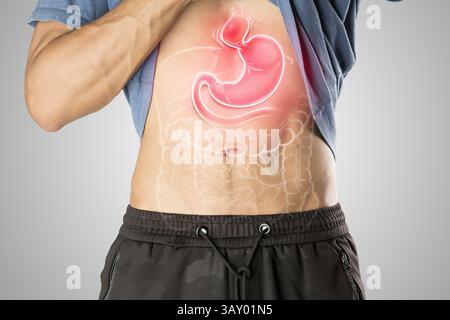 A Hiatal Hernia is illustrated with a line drawing showing the body’s ...