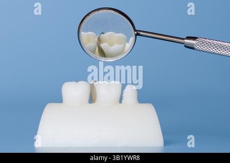 Dental sectional matrix contour system installation on a dummy on a ...