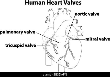 Detailed vector illustration of aortic valve disease, highlighting normal and stenosis ...