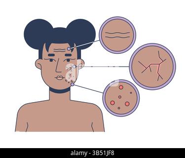 Skin conditions abstract concept vector illustration Stock Vector Image ...