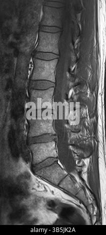 Computer tomograph. Magnetic resonance imaging Stock Photo - Alamy