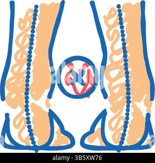 curvature of legs inward icon doodle illustration Stock Vector Image ...