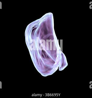 Illustration of a patella osteochondral fracture, showing a break ...