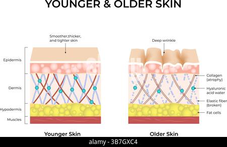 Aging process. comparison of Young and aged skin. Collagen, Elastin and ...