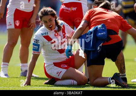 *EDITORS NOTE: BLOOD* Saint Helens' Emily Rudge with a bloody nose ...