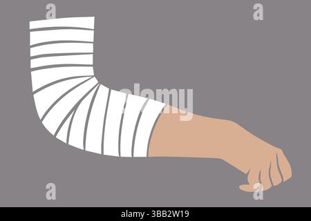 Vector isolated illustration of elbow bandaging. First aid for elbow ...