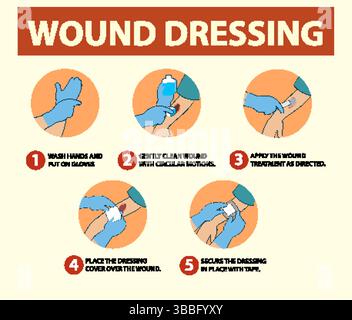 Illustration detailing the process of wound dressing with clear steps ...