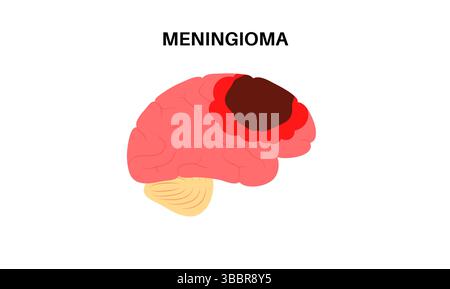 Meninges of the brain and spinal cord Stock Photo - Alamy