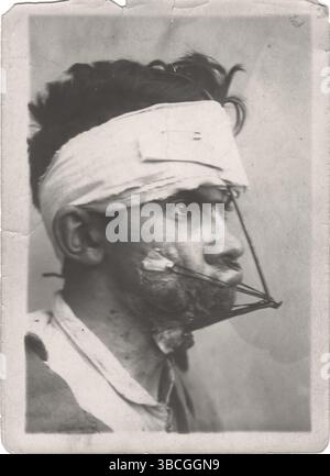 Medicine in Wartime - Soldier facial injuries 35 Stock Photo - Alamy