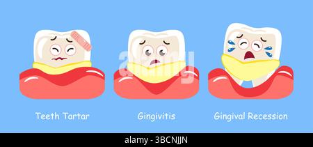 Vector illustration of gingival recession Stock Vector Image & Art - Alamy