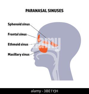 Paranasal sinuses. Illustration of a frontal section through the nasal ...